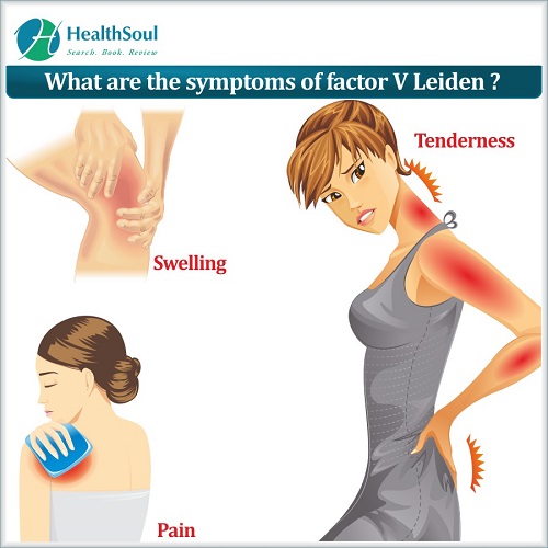 Factor V Leiden Symptoms Causes And Treatment Healthsoul Factor V Leiden Symptoms Causes And Treatment Healthsoul