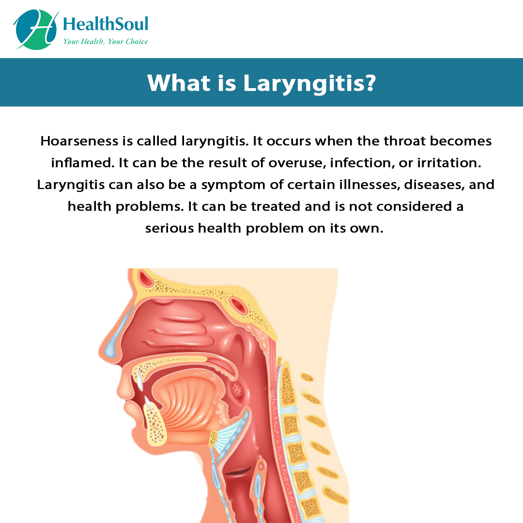 Laryngitis Healthsoul Laryngitis Healthsoul