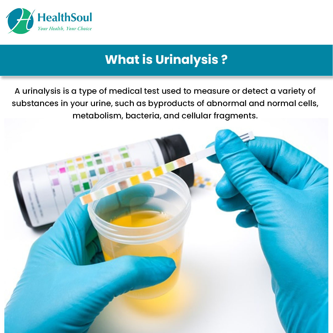 Urinalysis Healthsoul